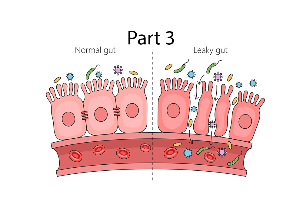 Dr. Emi's Guide to Leaky Gut: What You Need to Know Part 3: Testing for ...